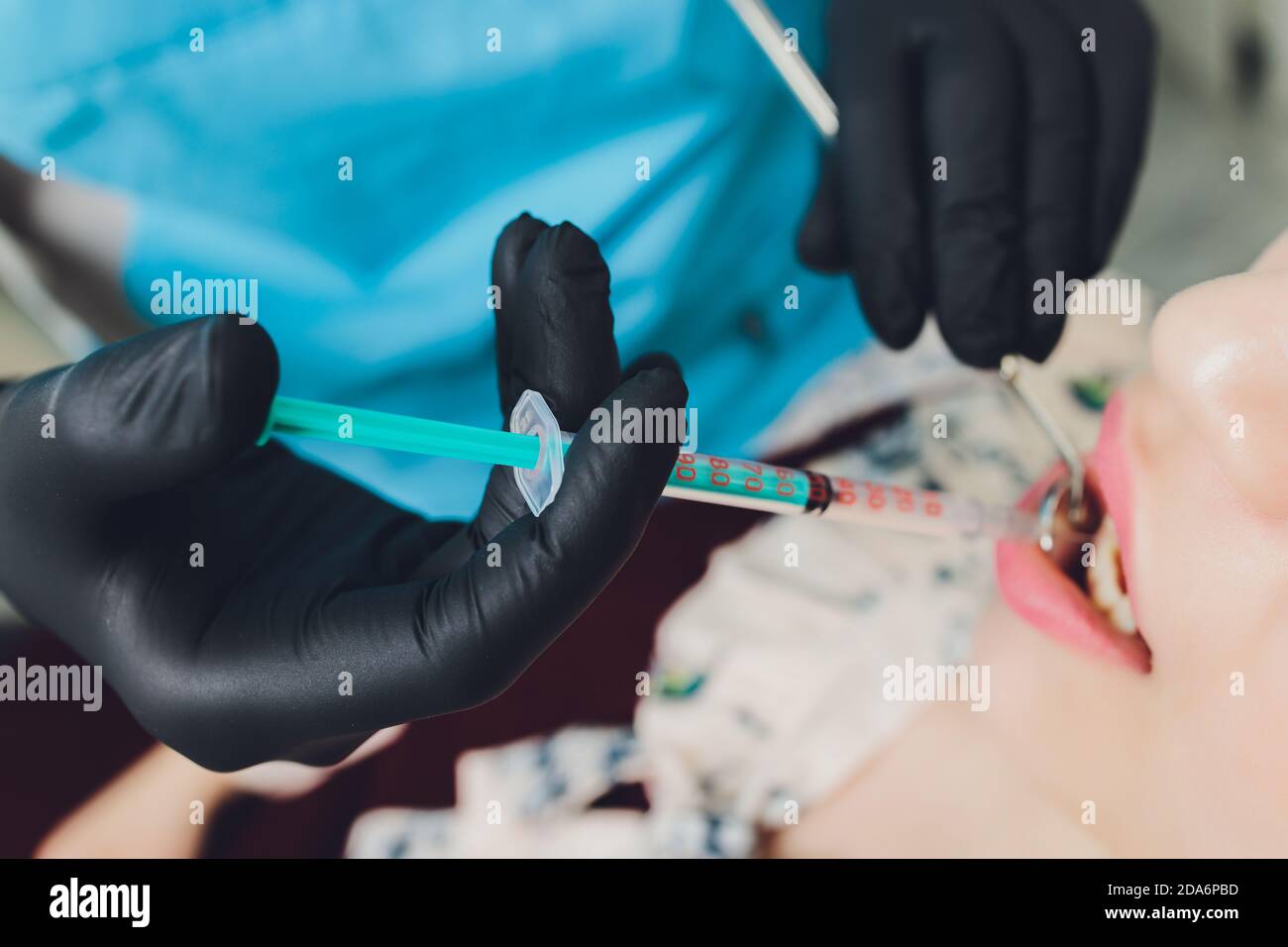 Dentist giving injection for anesthetizing his patient Stock Photo - Alamy