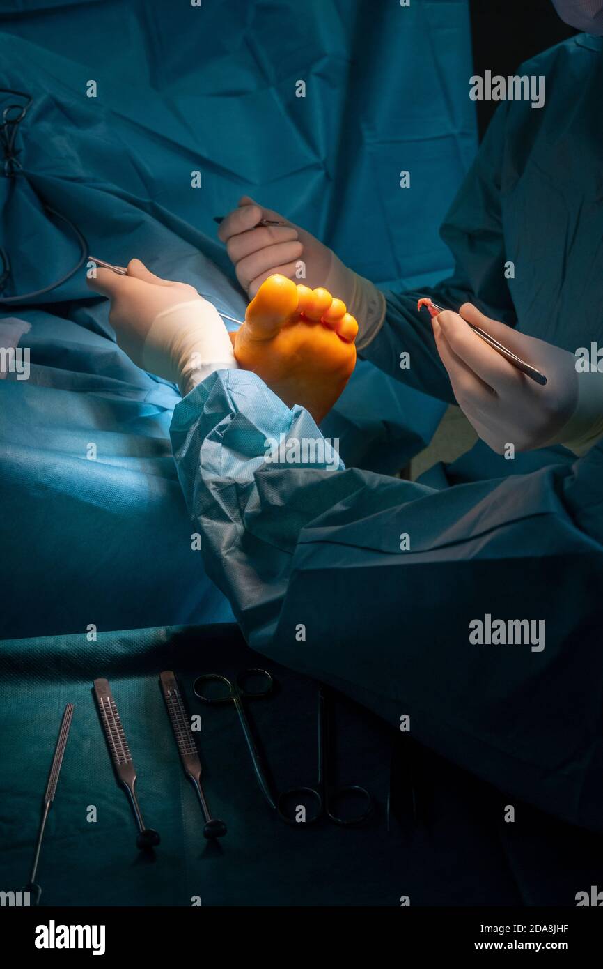 surgeon makes an incision on one foot with a scalpel Stock Photo - Alamy