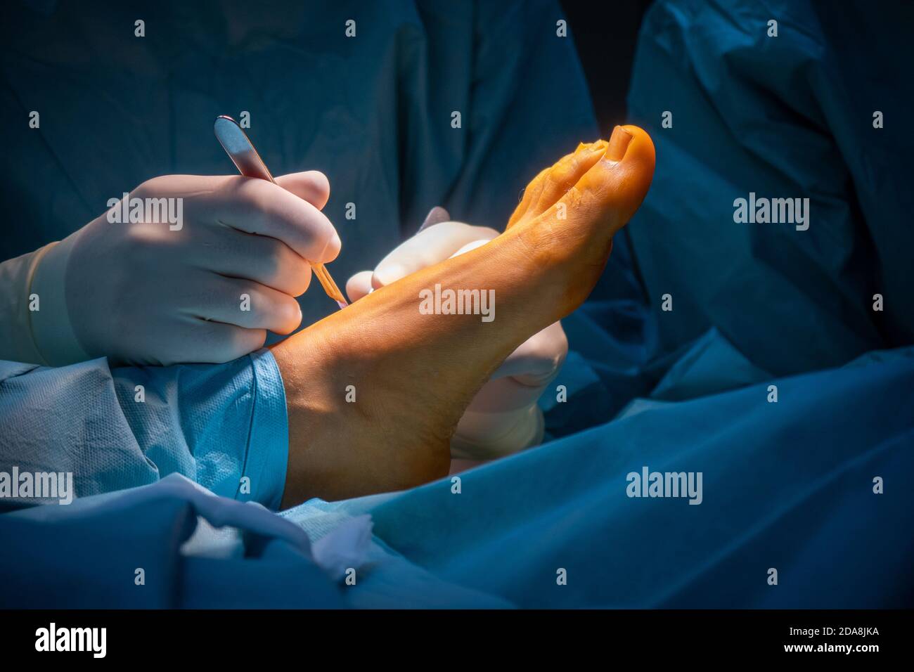 a surgeon makes an incision on one foot with a scalpel Stock Photo - Alamy