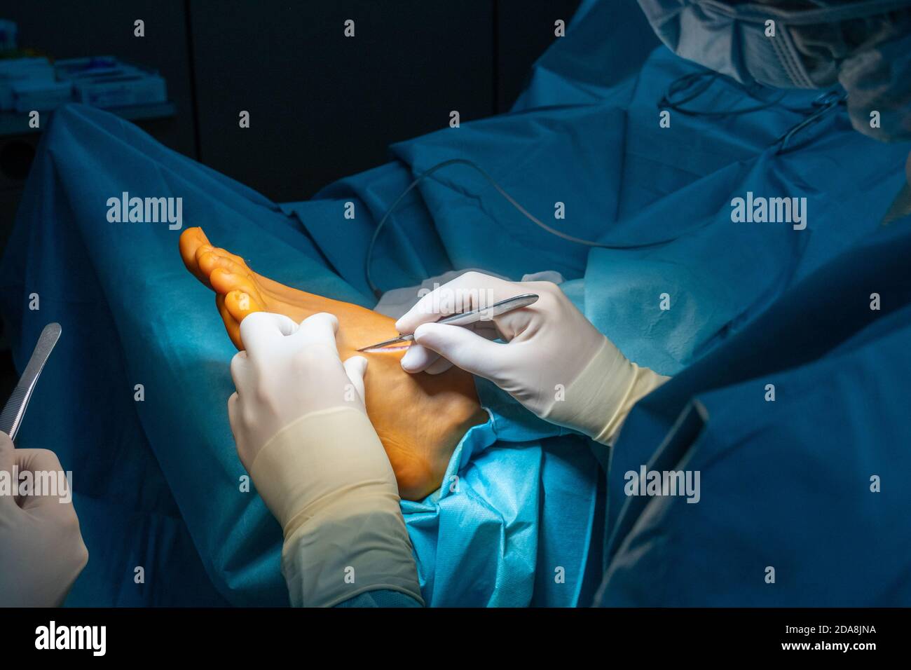 a surgeon makes an incision on one foot with a scalpel Stock Photo - Alamy
