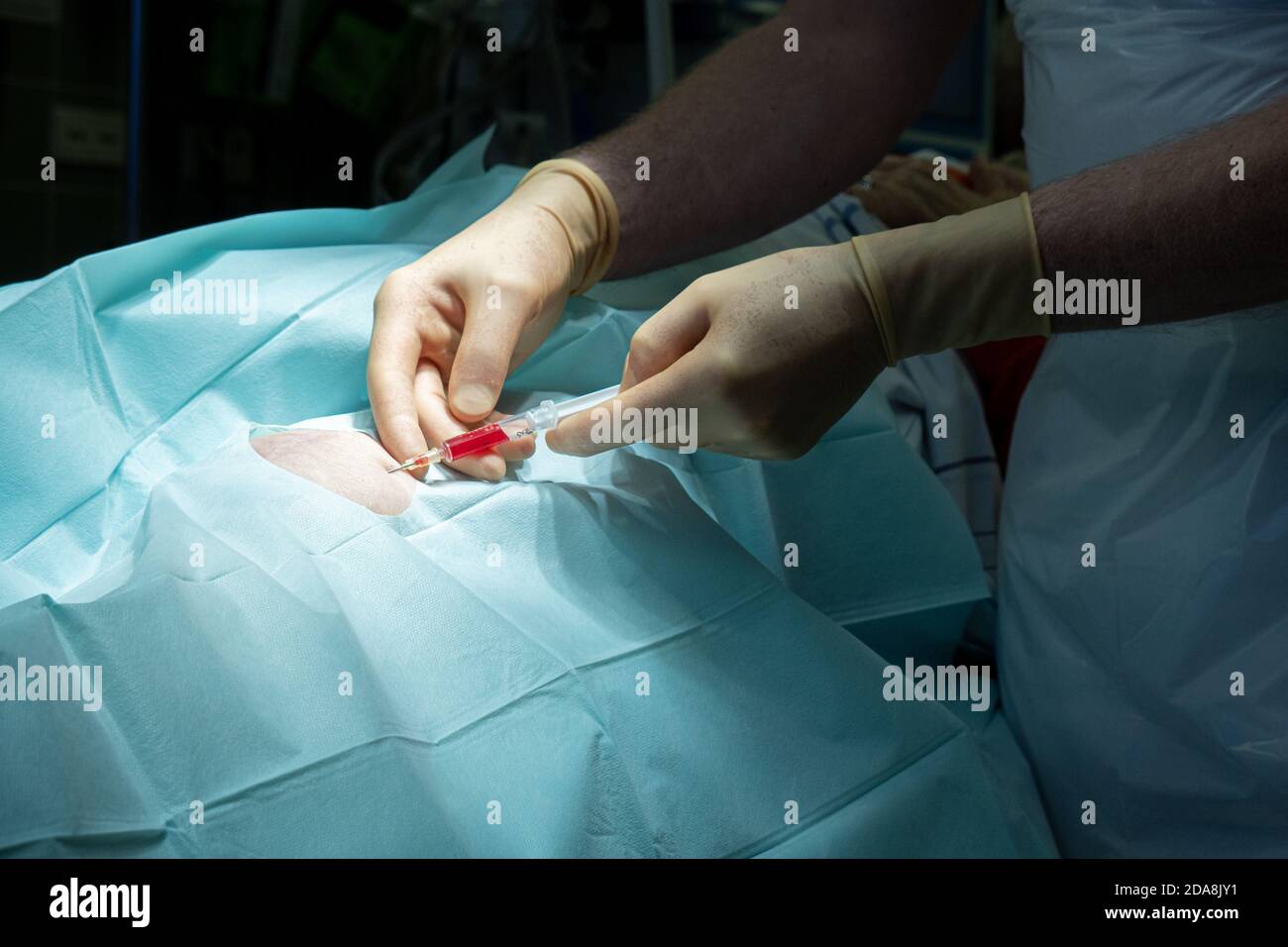 a doctor performs a knee puncture in an operating room with a cannula ...