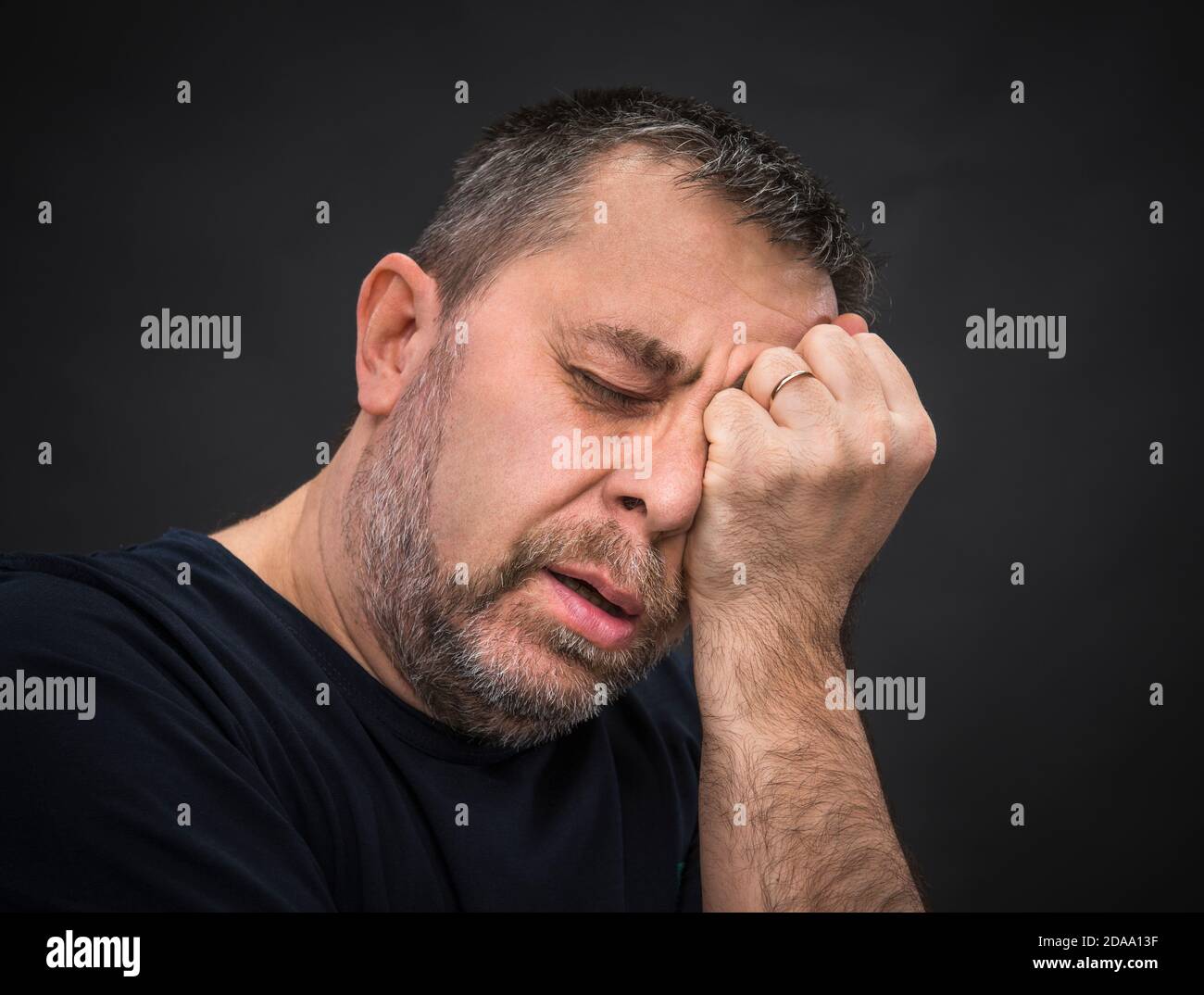 Headache. Portrait of an elderly man with face closed by hand Stock ...