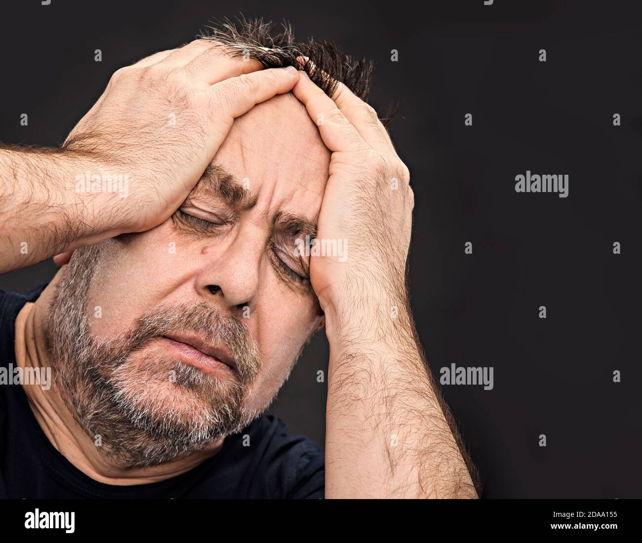 Headache. Portrait of an elderly man with face closed by hand Stock ...