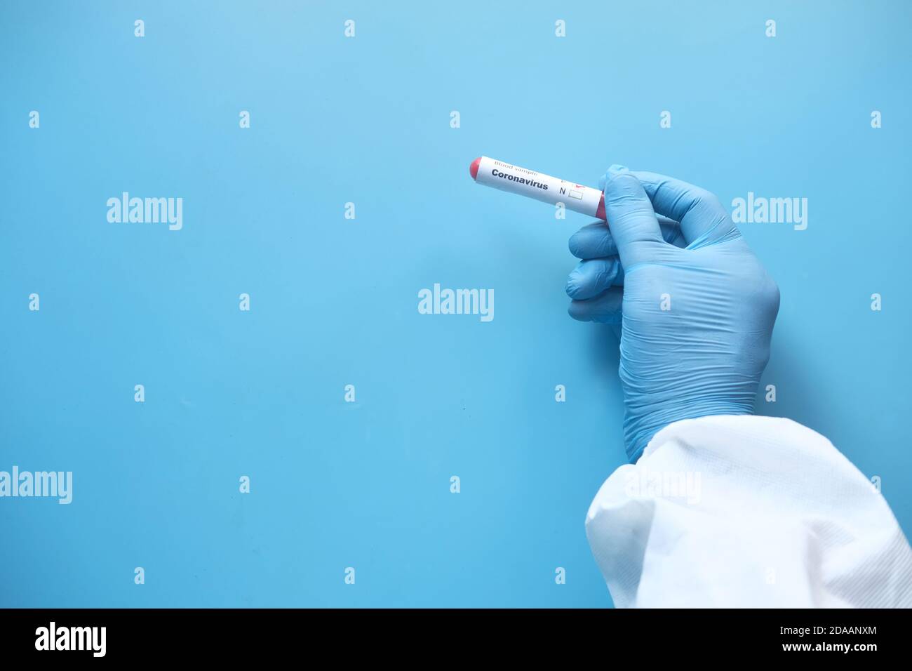 laboratory technician hand holding blood test tube Stock Photo - Alamy