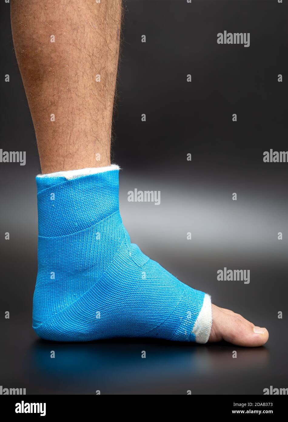 Blue splint ankle. Bandaged leg cast on male patient on dark blurred ...