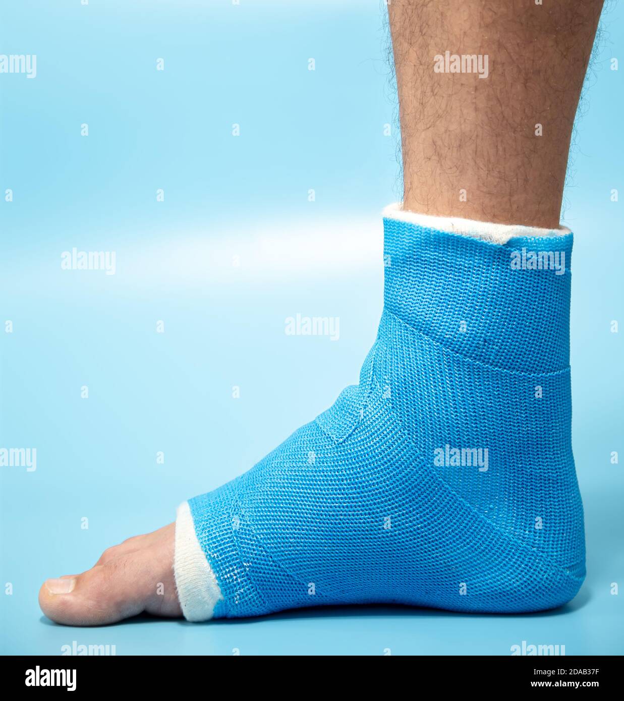 Blue splint ankle. Bandaged leg cast on male patient on light blue ...