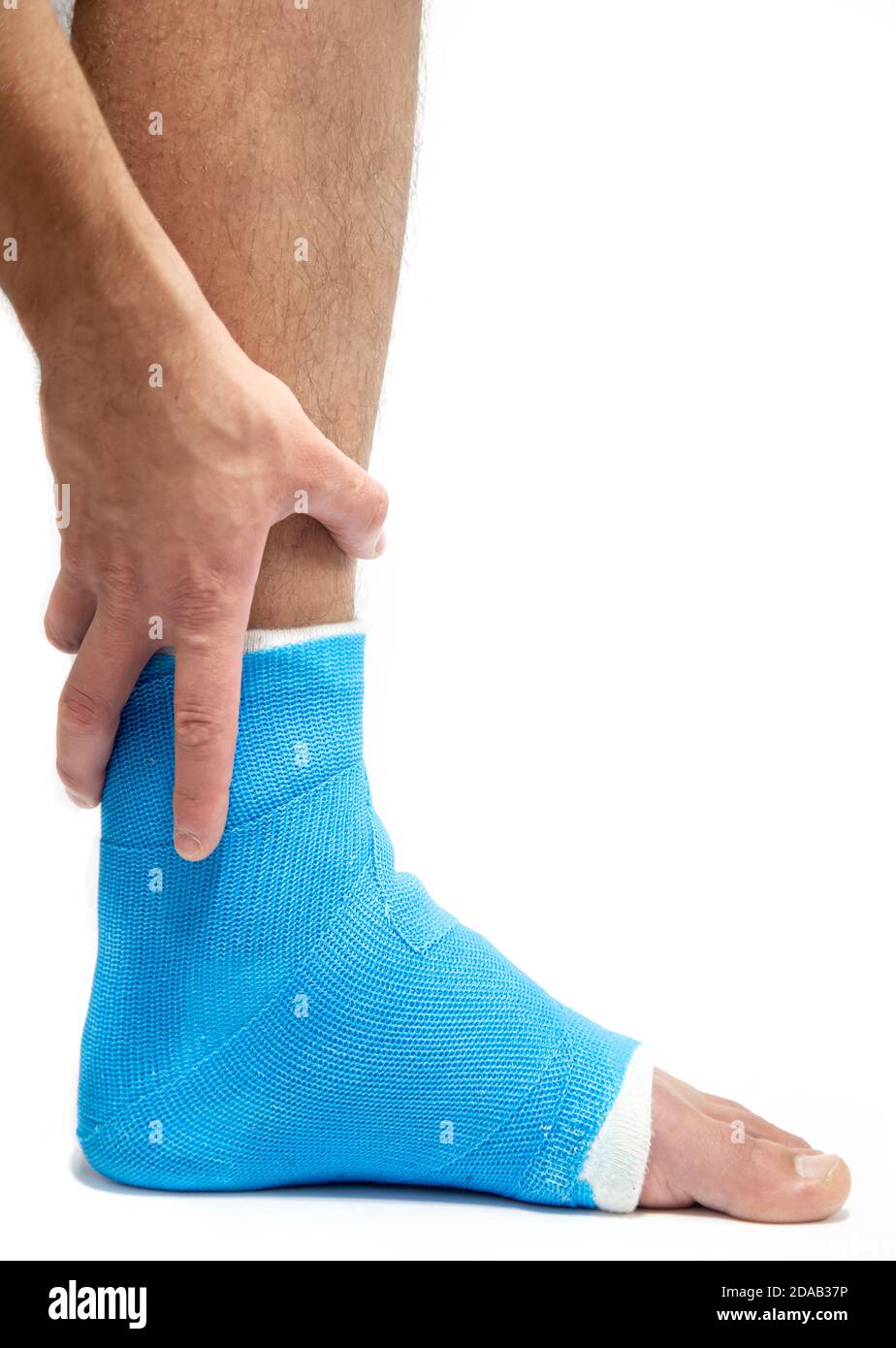 Blue splint ankle. Bandaged leg cast on male patient on white ...