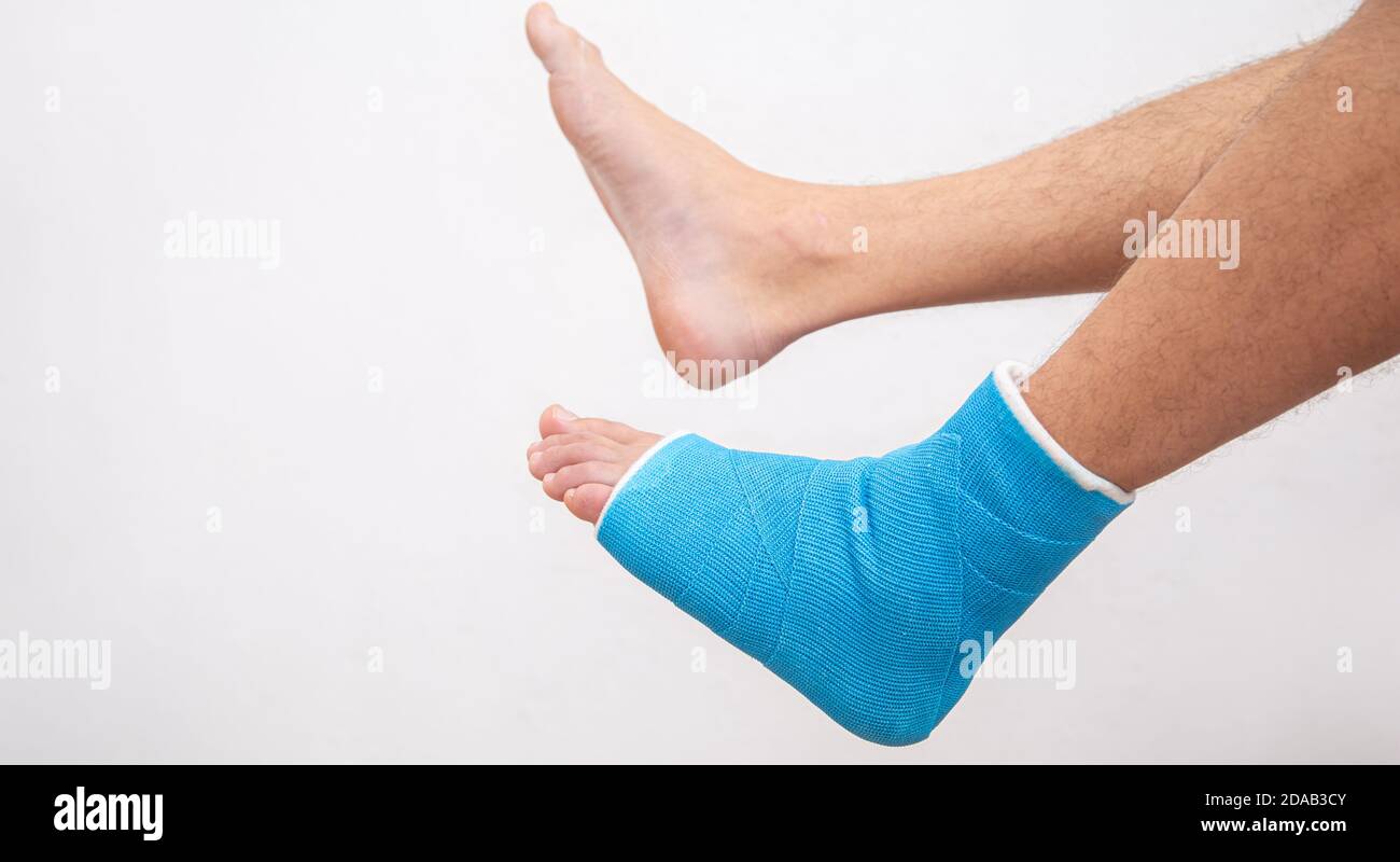 Blue splint ankle. Bandaged leg cast on male patient on white ...