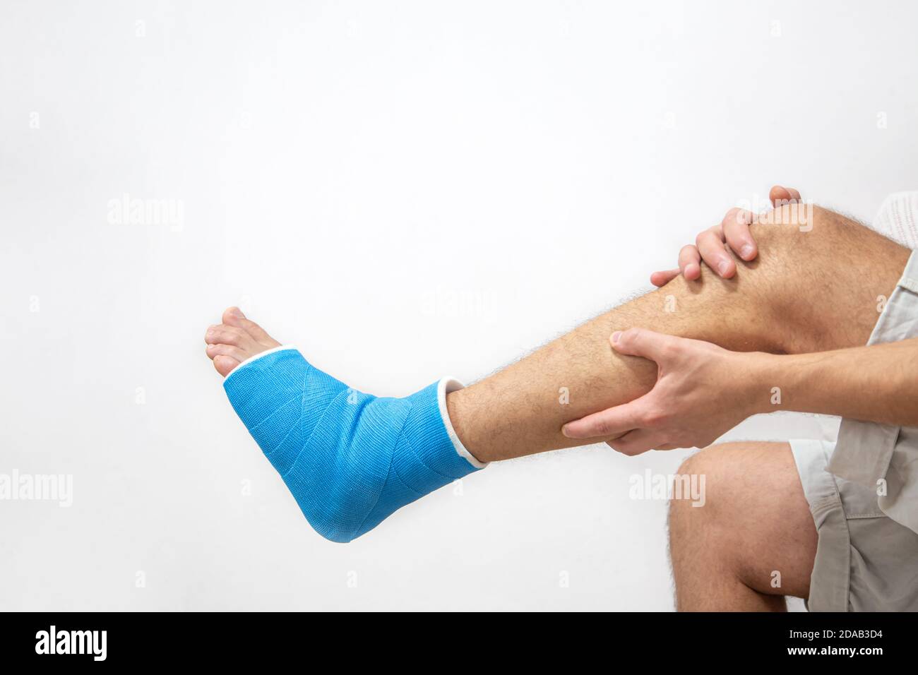Blue splint ankle. Bandaged leg cast on male patient on white ...