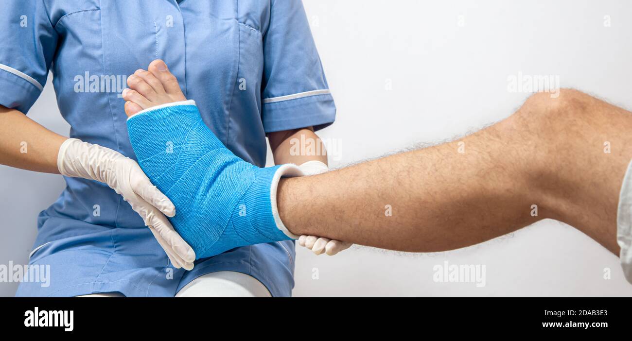 Close up of a man's leg in a cast and a blue splint after bandaging in ...