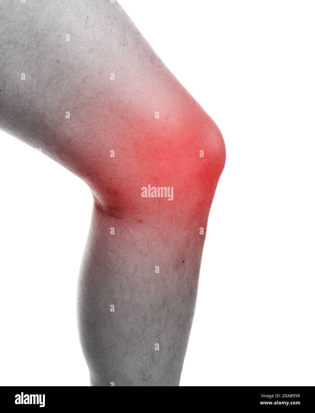 Closeup shot of a person's injured knee - joint pain, arthritis and ...