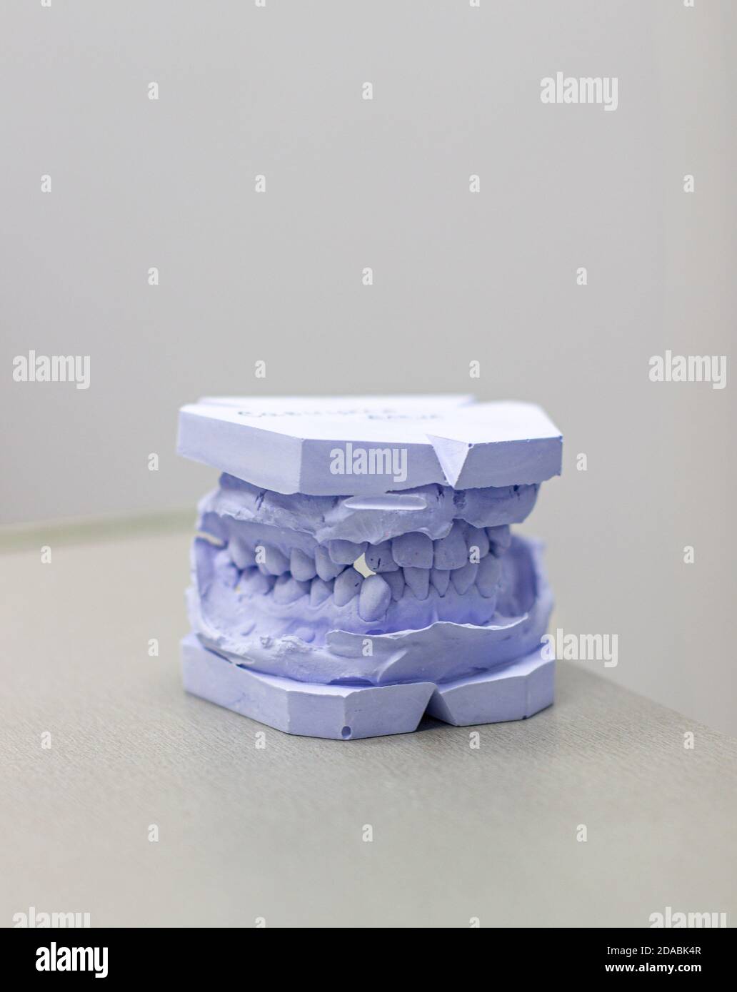 Dental cast plaster model hi-res stock photography and images - Alamy
