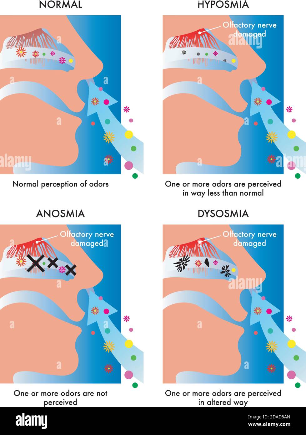 Illustration shows in a symbolic and simple way the symptoms of three ...