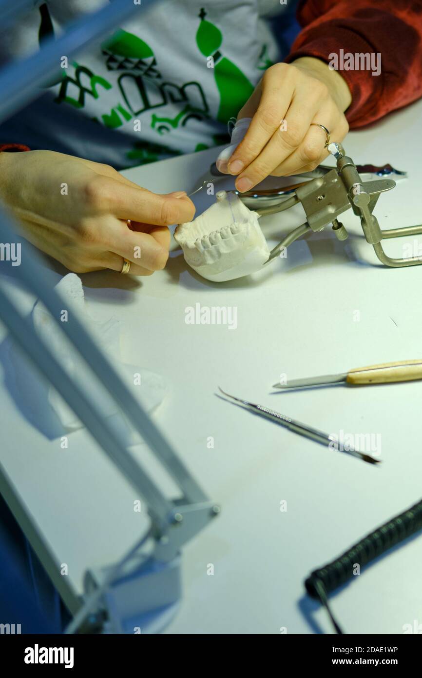 The dentist's hands are working on making prosthetic teeth to replace ...