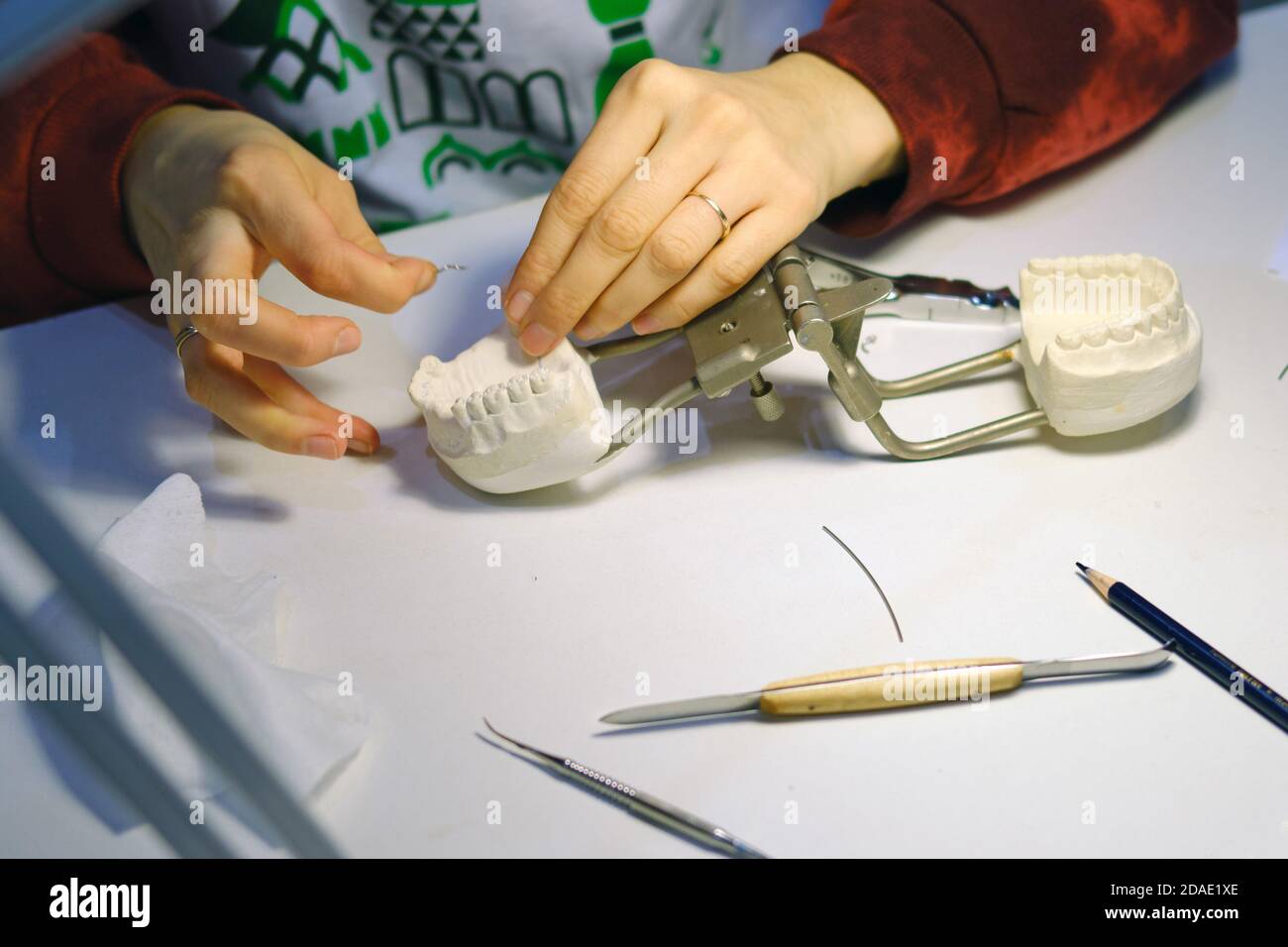 A dentist is working on a cast of a patient's dental jaw to create a ...