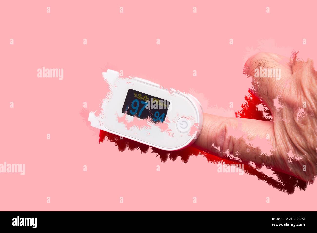 The process of measuring the level of oxygen in the blood. Concept. A ...