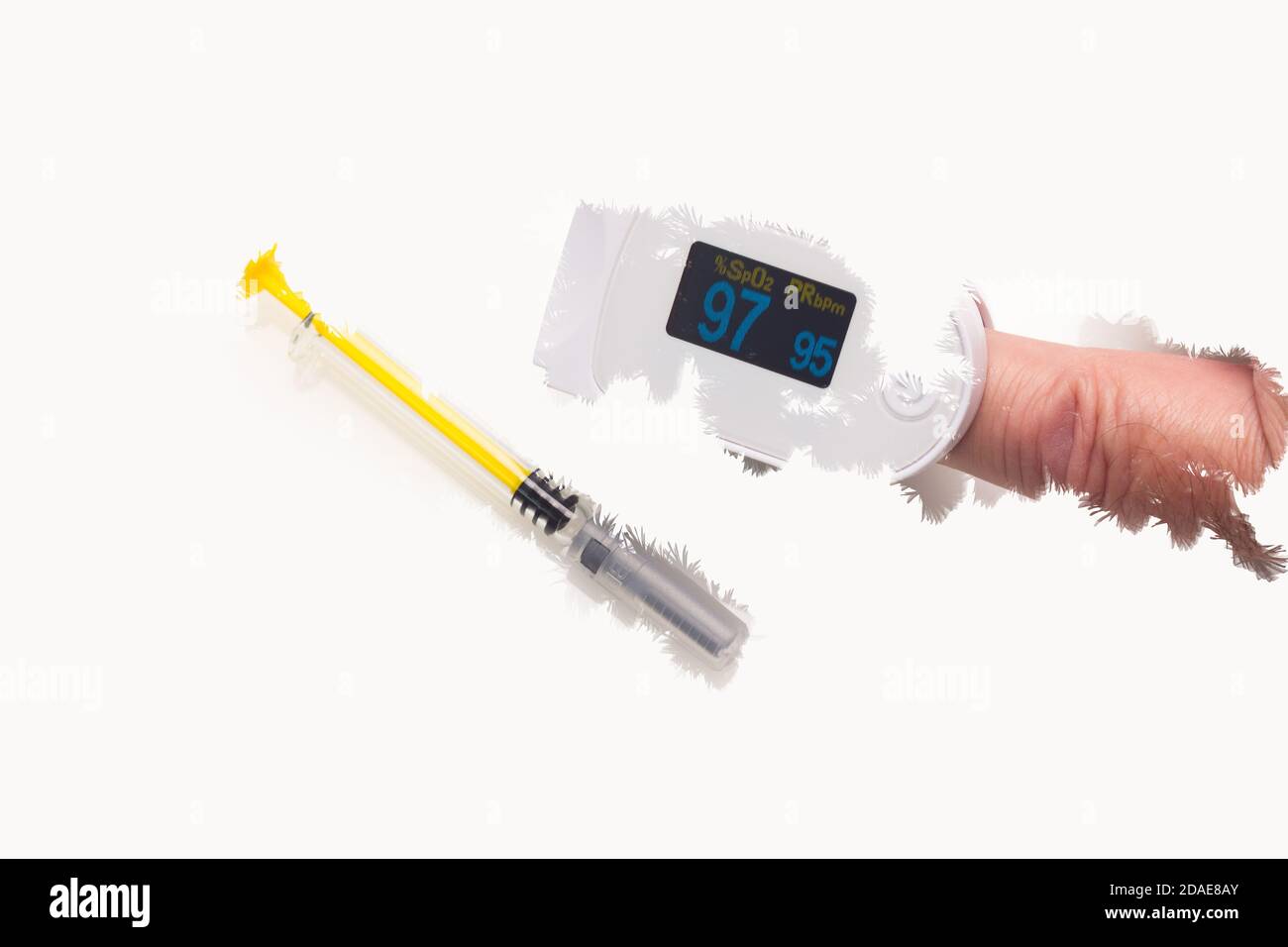 The process of measuring the level of oxygen in the blood. Concept. A ...