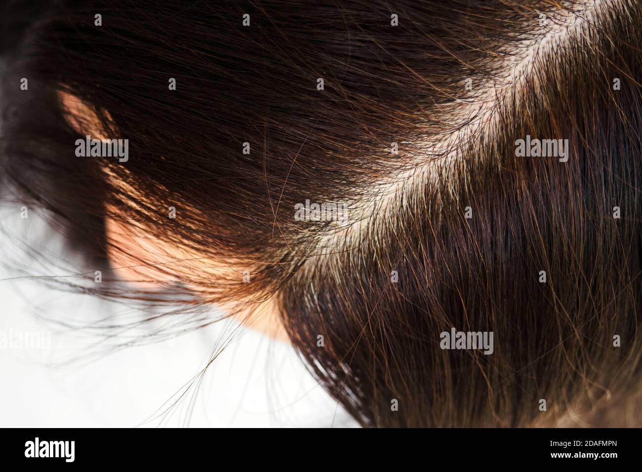 Dark gray head hi-res stock photography and images - Alamy