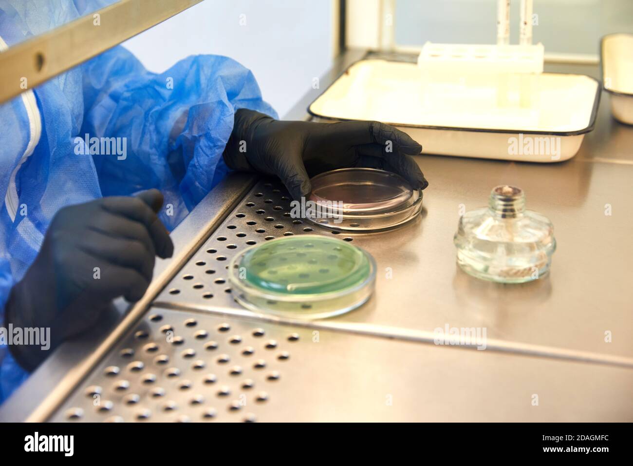 Bacterial growth tube hi-res stock photography and images - Alamy