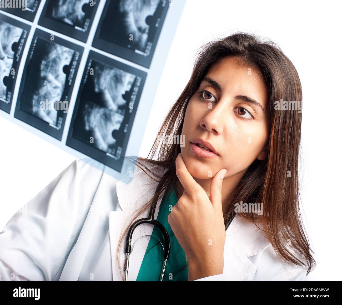 Doctor examining a mammogram Stock Photo - Alamy