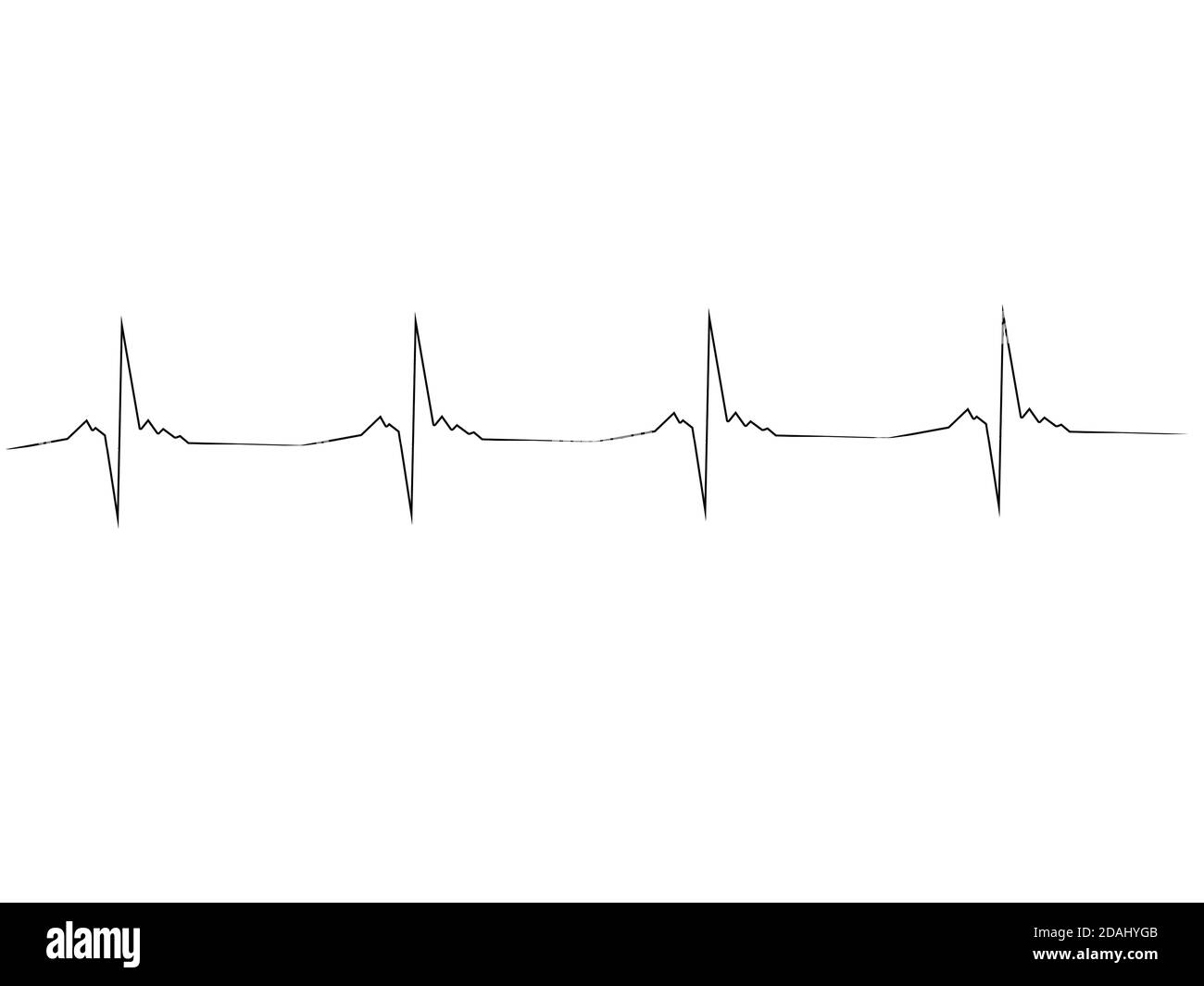 Line of an EKG on white background Stock Photo - Alamy
