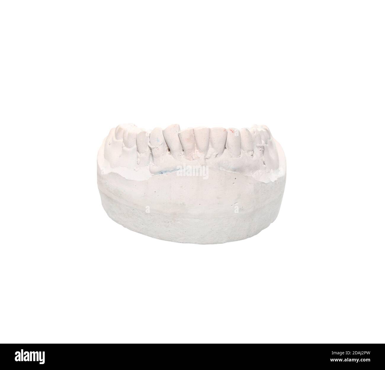Closeup shot of plaster models of teeth isolated on white background ...