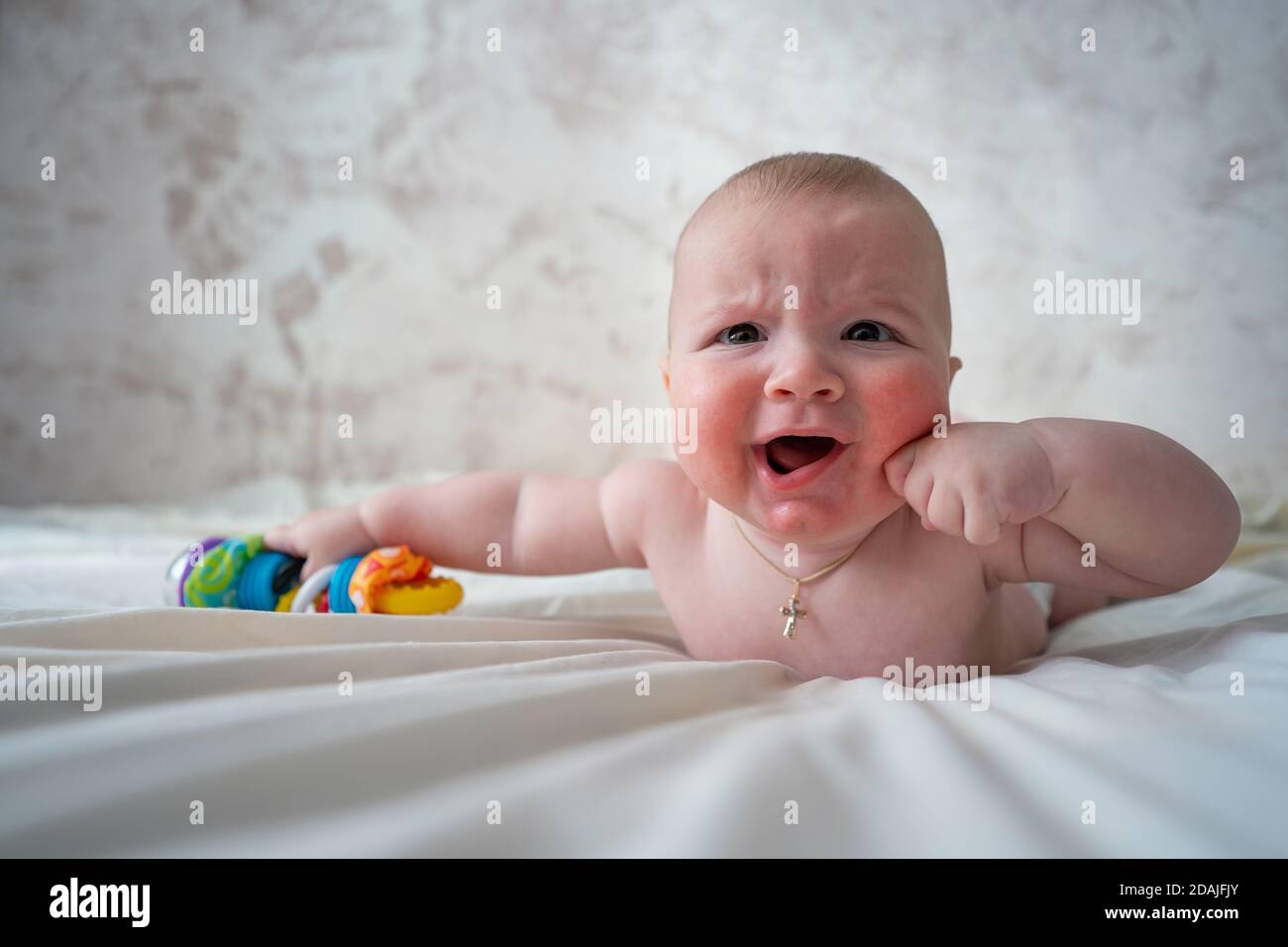 Close-up of a baby with skin Allergy lying on the bed. Close-up of a ...