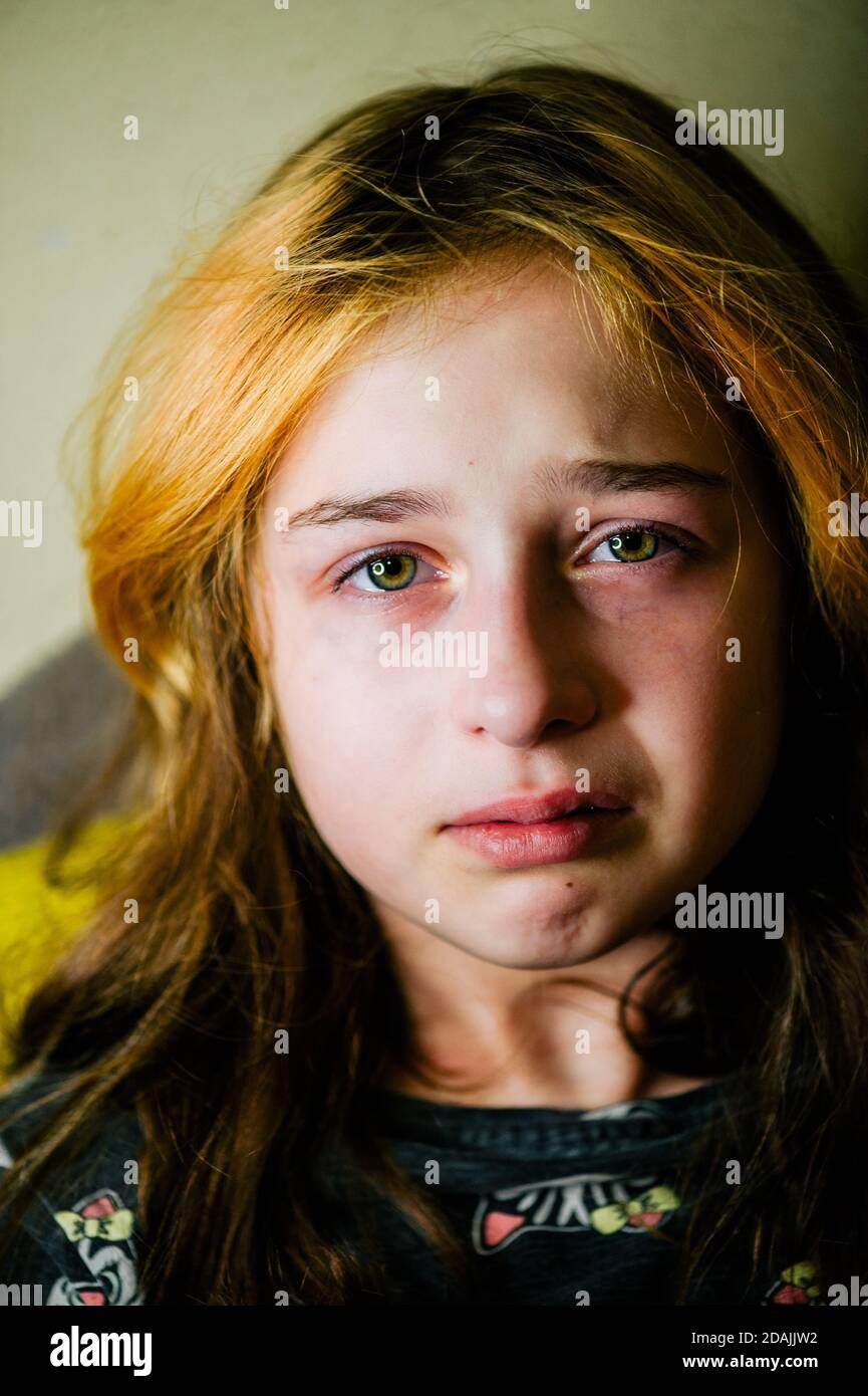 little sad girl after crying. Crying little beautiful girl with sad ...