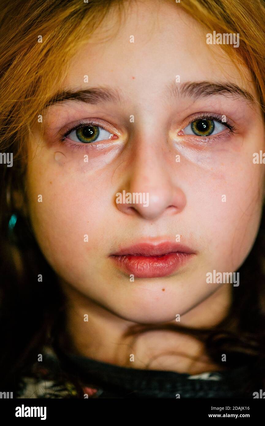 little sad girl after crying. Crying little beautiful girl with sad ...