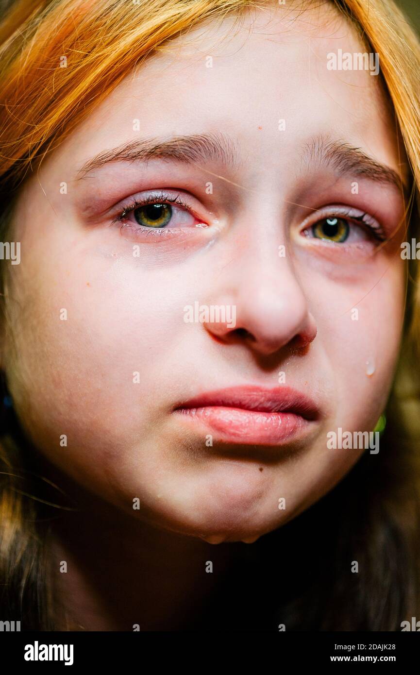 little sad girl after crying. Crying little beautiful girl with sad ...