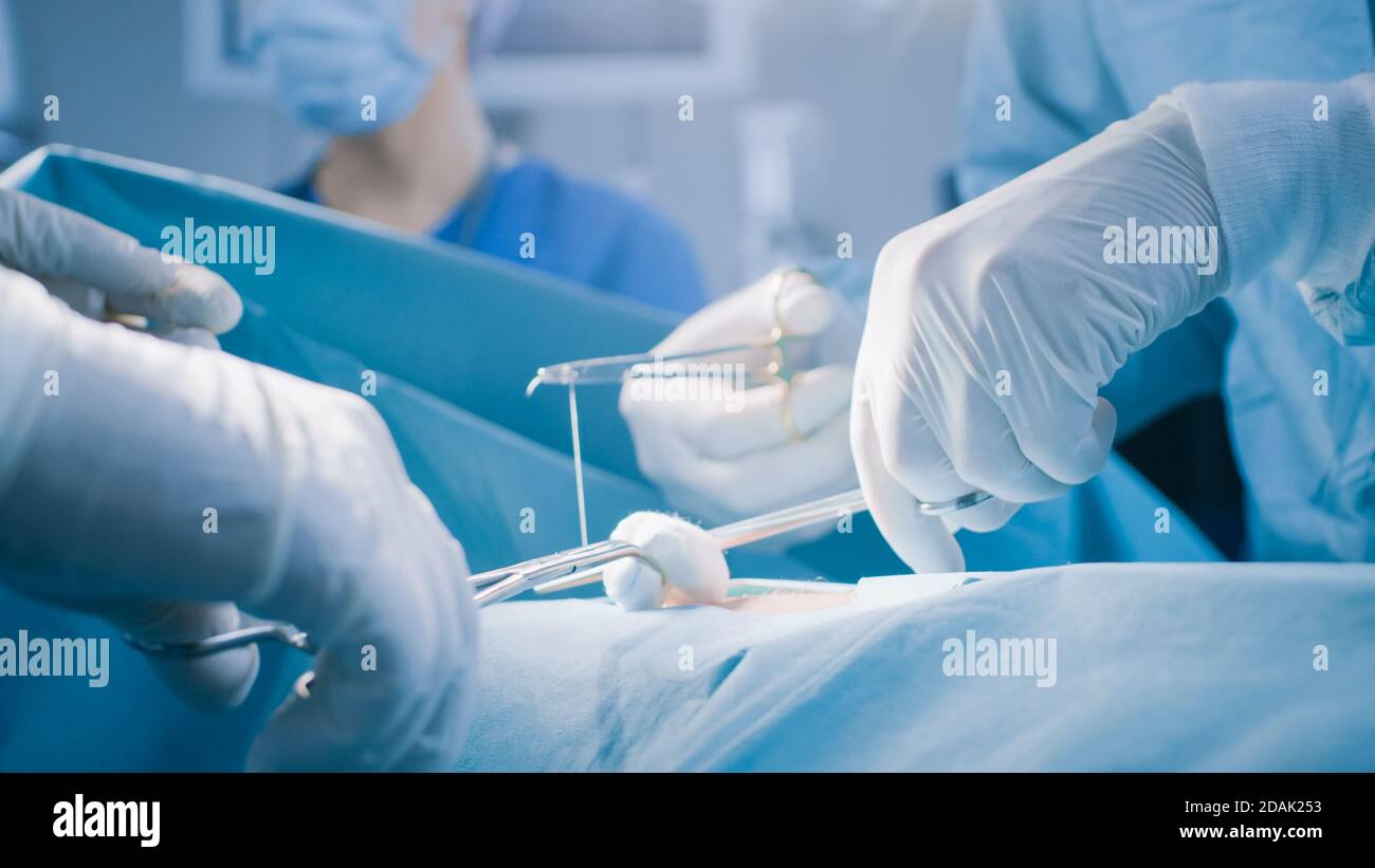 Close-up on Professional Surgeon Suture Wound after Successful Surgery ...