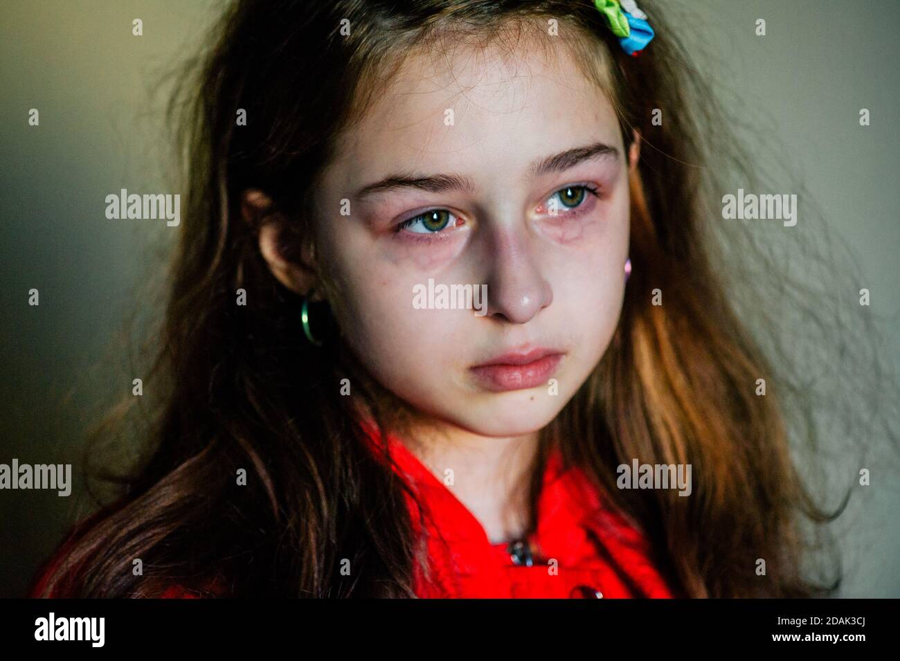 little sad girl after crying. Crying little beautiful girl with sad ...