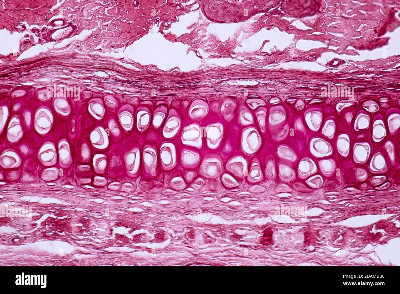 Human cartilage and bone, light micrograph Stock Photo - Alamy