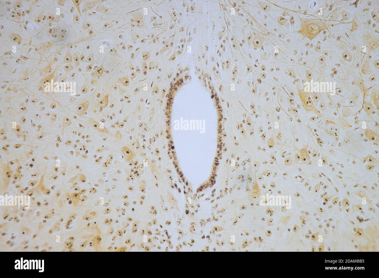Light micrograph of neurons (nerve cells) from the spinal cord Stock ...