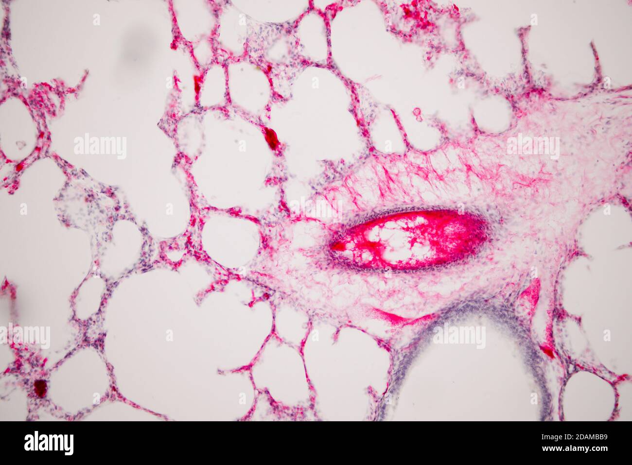 Human lung normal tissue hi-res stock photography and images - Alamy