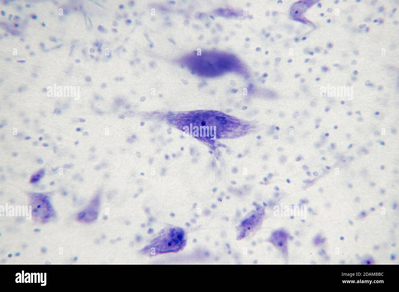 Light micrograph of nerve cells (large, purple) and support cells ...