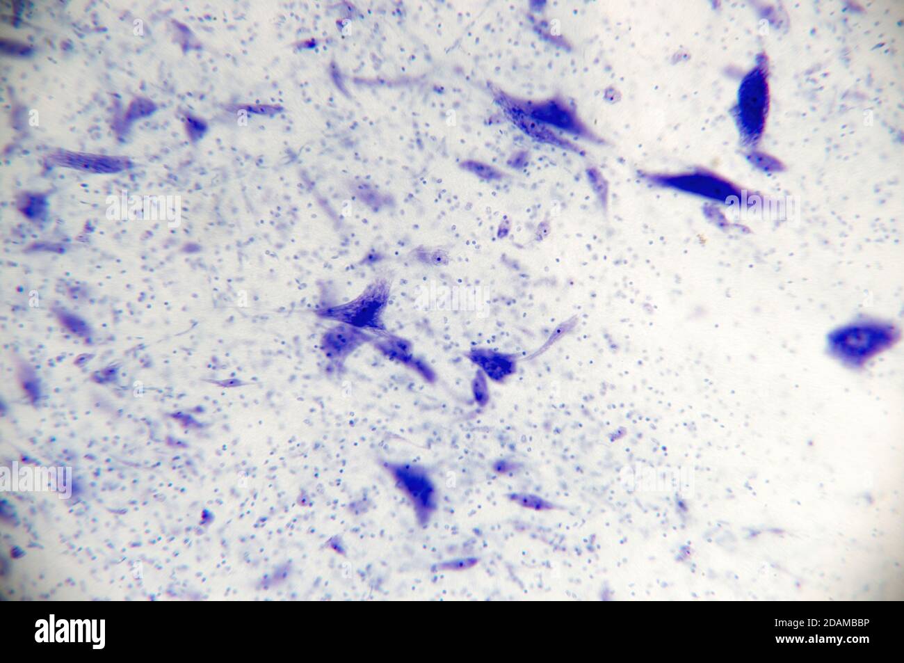 Nerve cell micrograph hi-res stock photography and images - Alamy