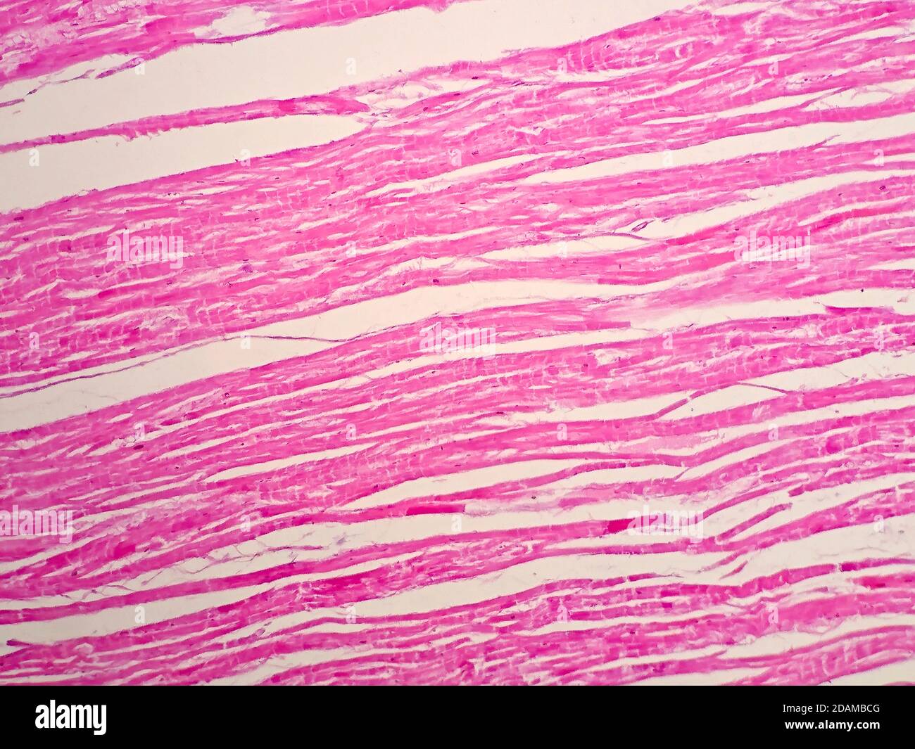 Human cardiac muscle, light micrograph. Cardiac muscle is one of the ...
