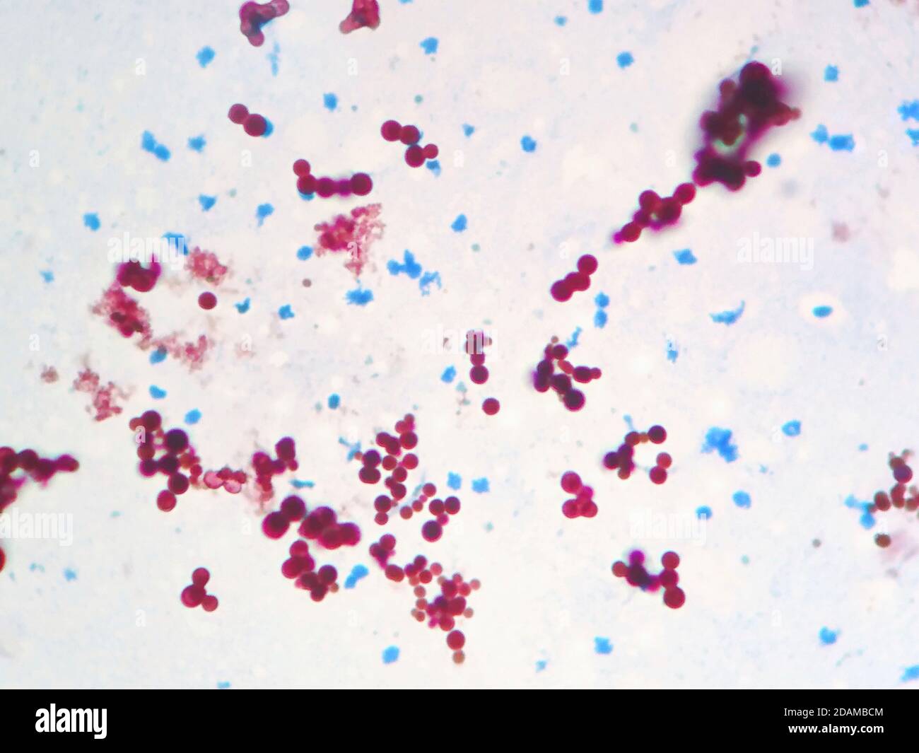 Mycobacterium marinum bacteria, light micrograph. Mycobacterium marinum ...
