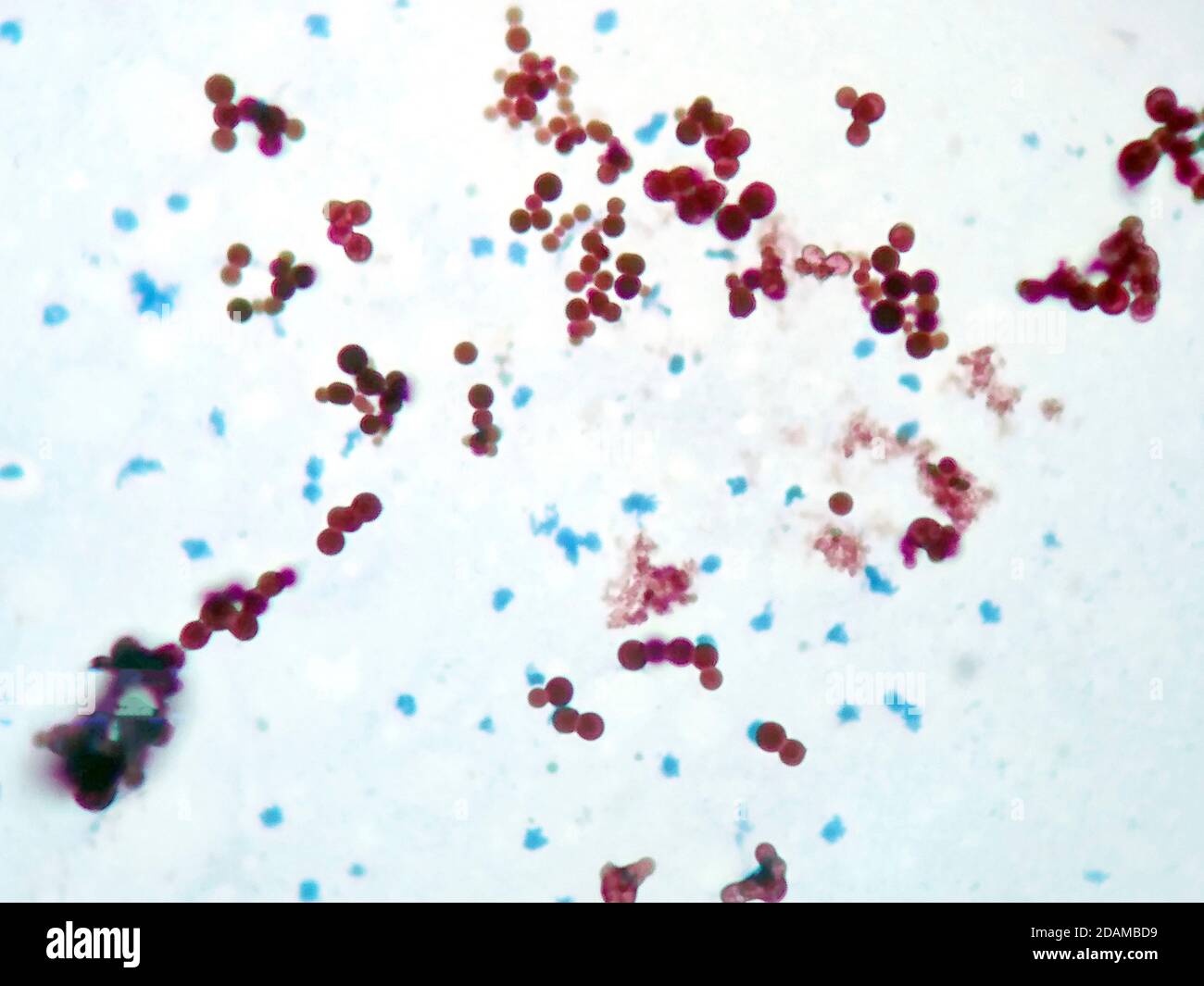 Mycobacterium marinum bacteria, light micrograph. Mycobacterium marinum ...