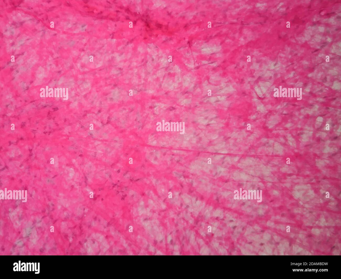 Reticular tissue micrograph hi-res stock photography and images - Alamy