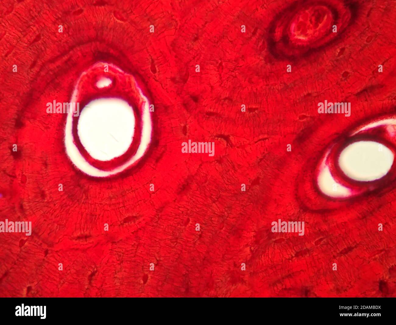 Human compact bone tissue, light micrograph Stock Photo - Alamy