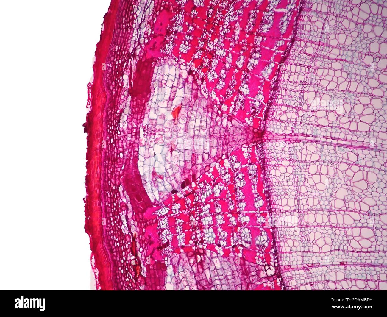 Phloem micrograph hi-res stock photography and images - Alamy