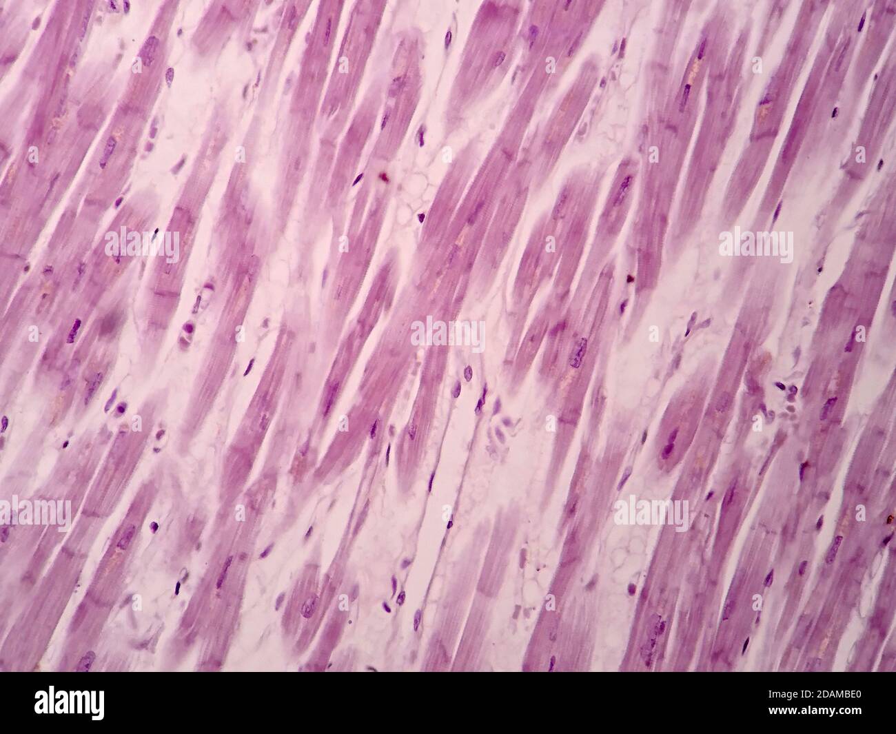 Cardiac muscle tissue hi-res stock photography and images - Alamy