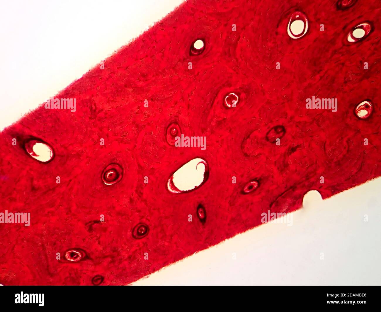 Human compact bone tissue, light micrograph Stock Photo - Alamy