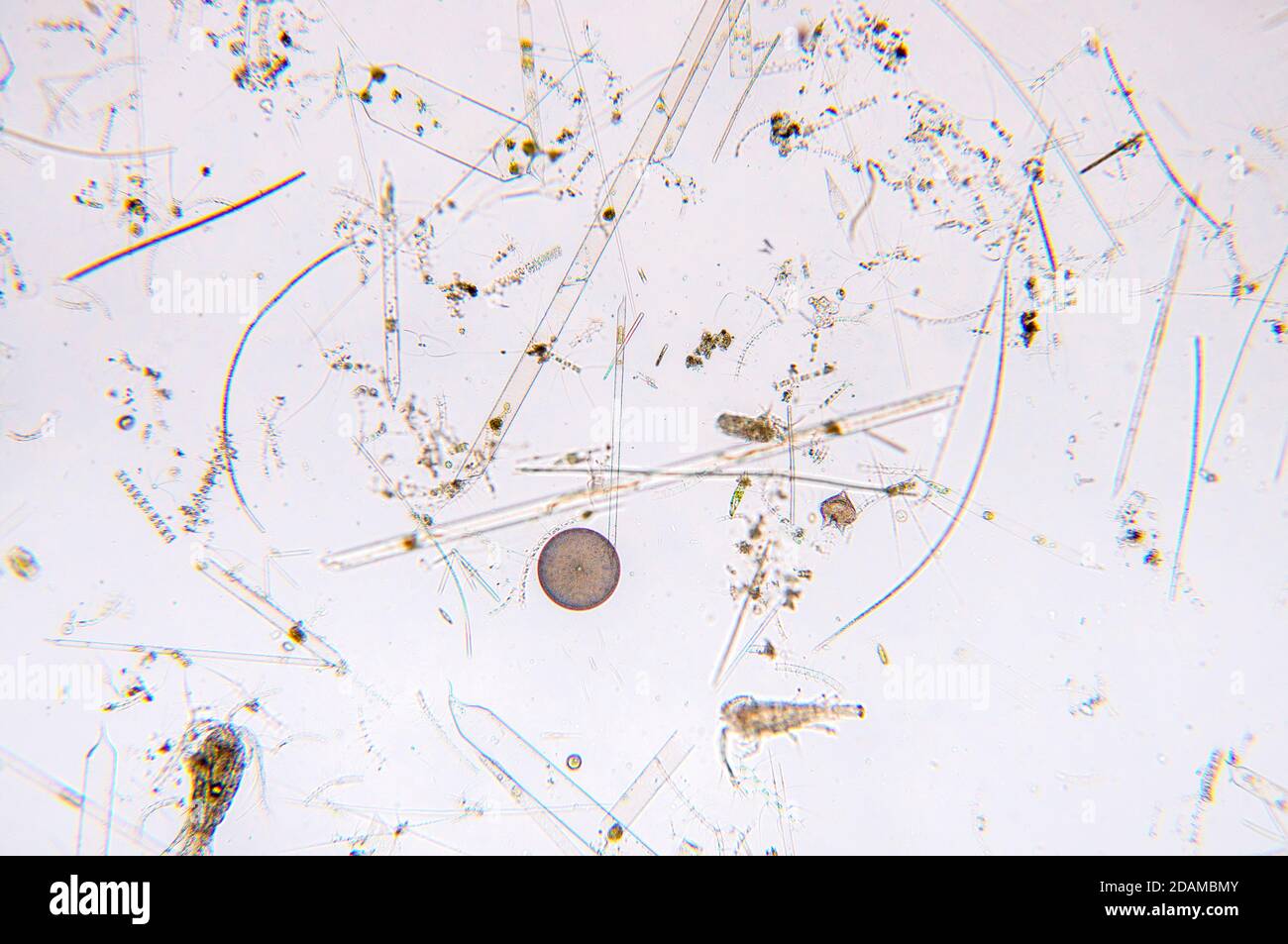 Marine plankton, light micrograph Stock Photo - Alamy