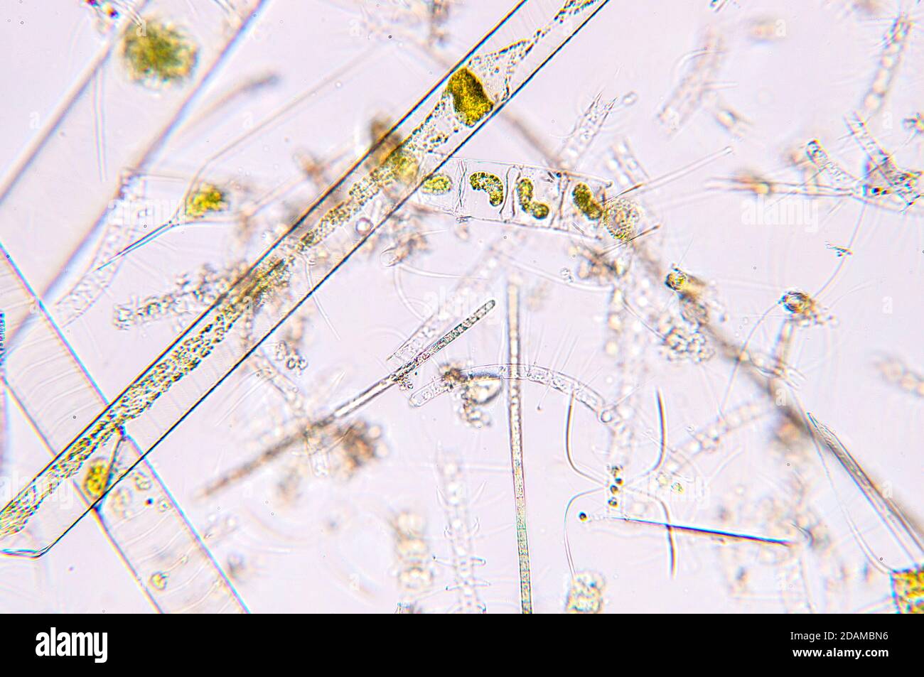 Marine plankton, light micrograph Stock Photo - Alamy