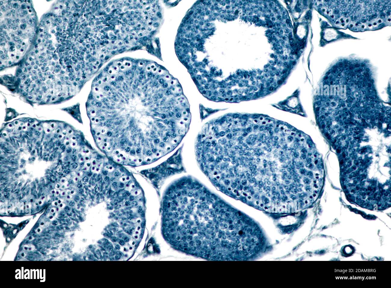 Human testis, light micrograph. Cross-section showing spermatogonia ...