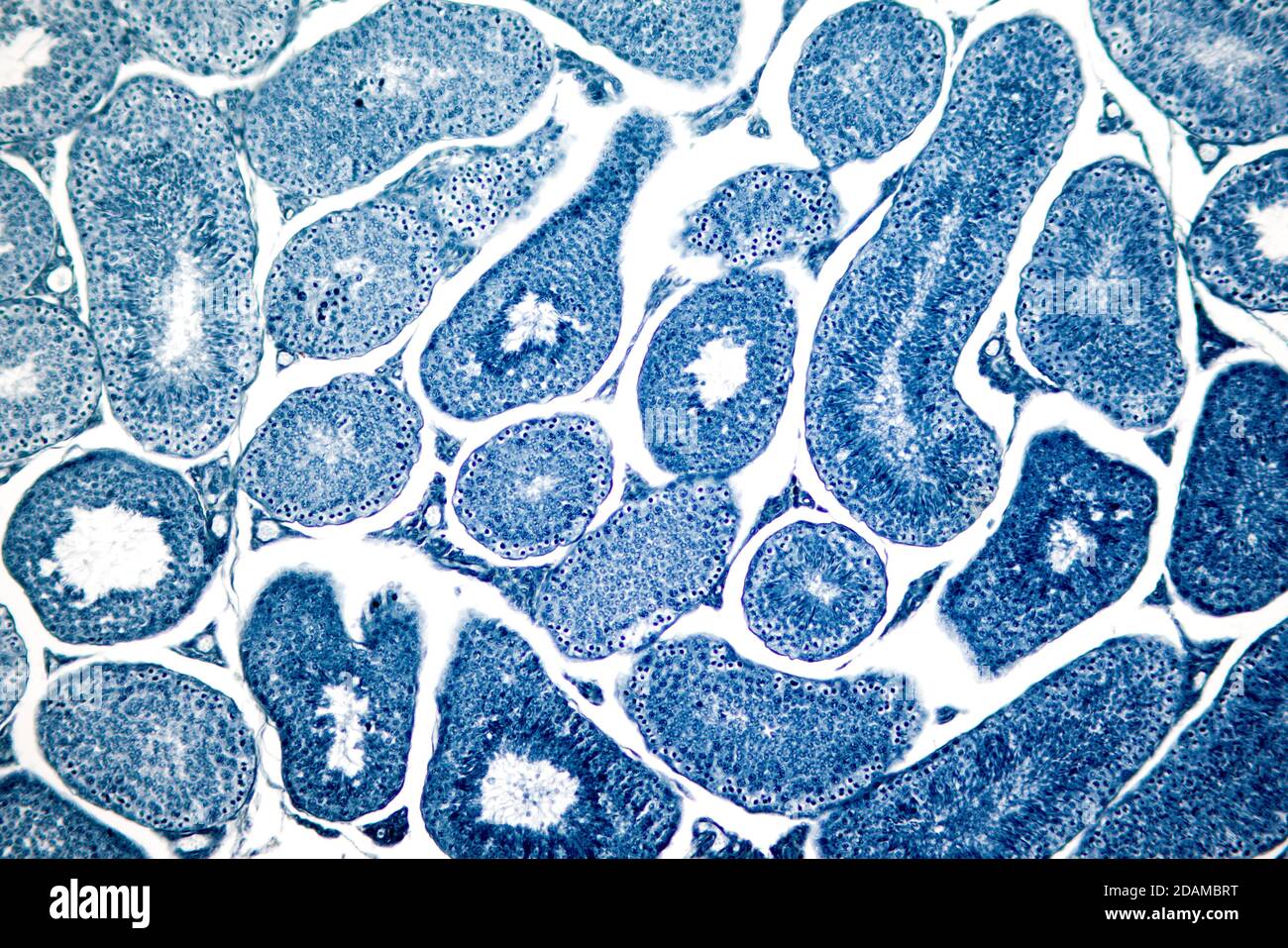 Human Testis Light Micrograph Cross Section Showing Spermatogonia