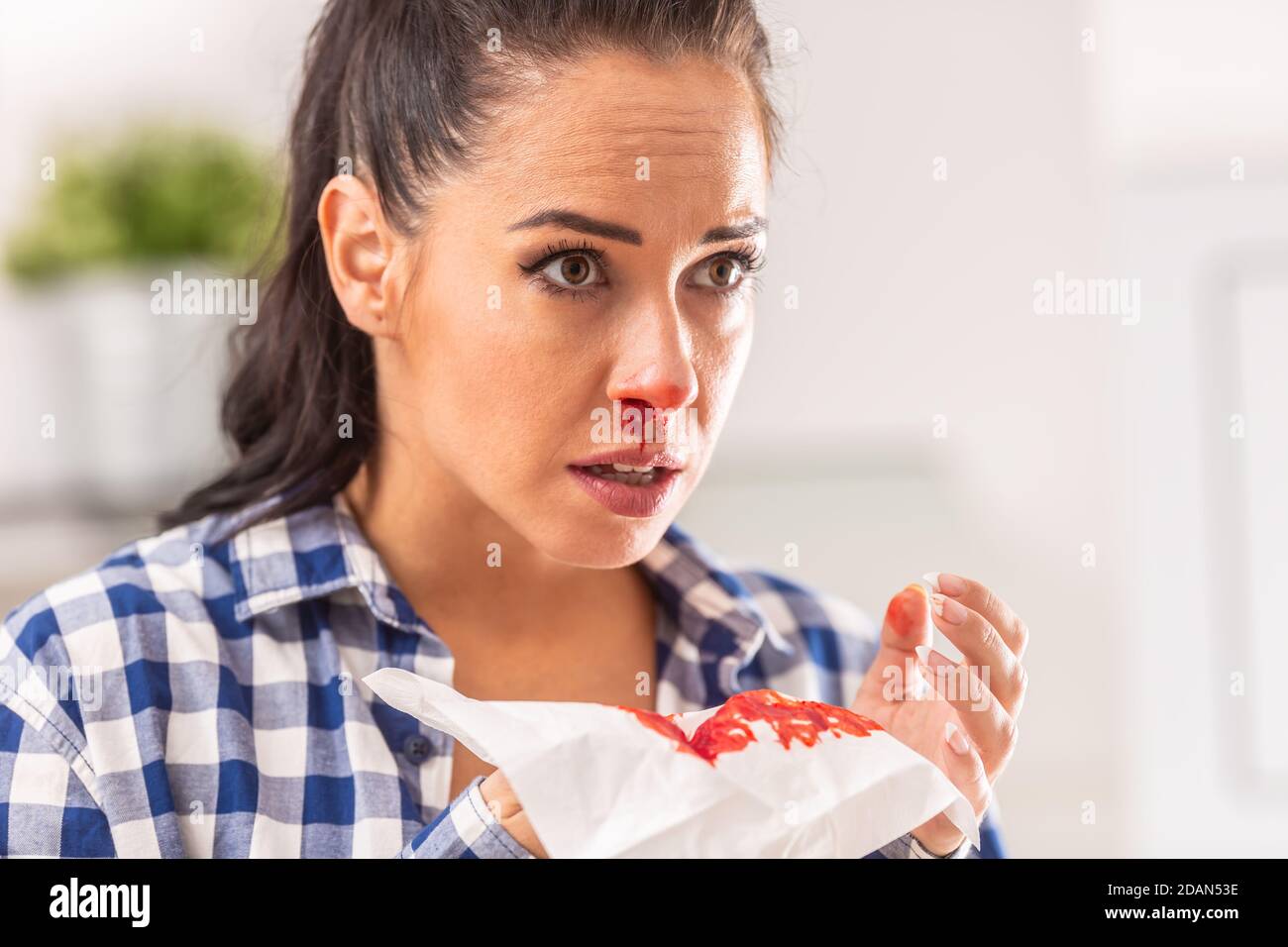 Nose bleed hi-res stock photography and images - Alamy